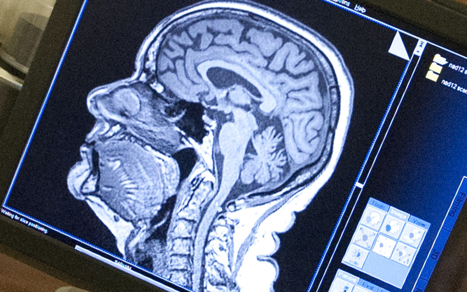 Listening Through Science - SNF Paideia Program at the University of ...